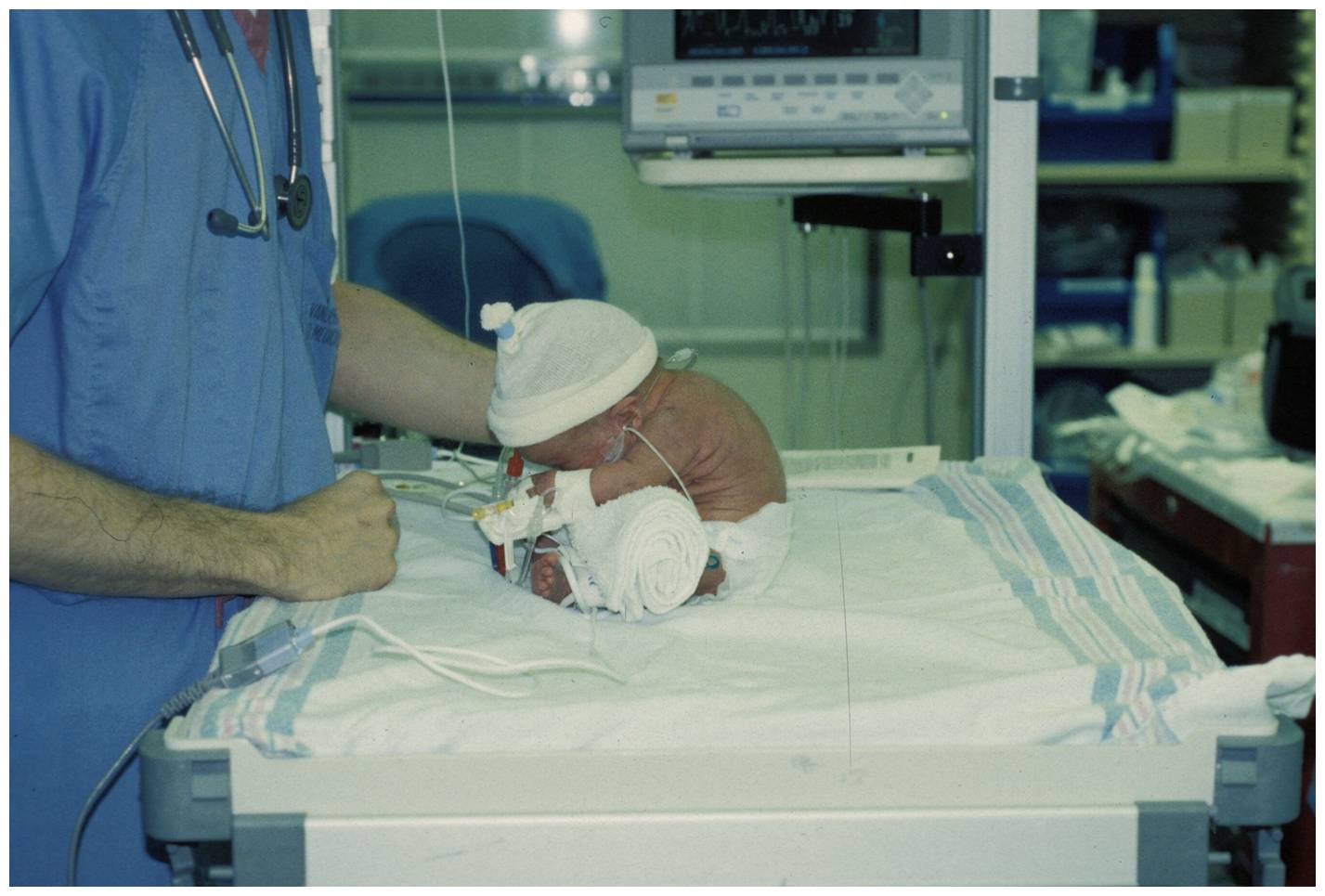 19-1 | Basics of Pediatric Anesthesia/Pediatric Anesthesia Article of ...