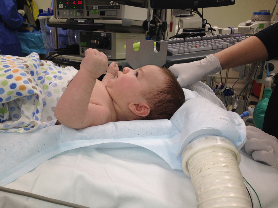 Chapter 16. Routine Airway Management | Basics of Pediatric Anesthesia ...